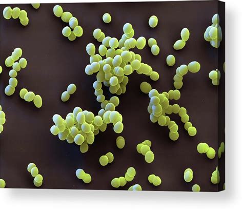 Enterococcus Gram Stain Morphology Enterococcus Gram Stain Morphology