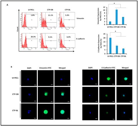 Emt In Ctp Db And Bl Cultures A Vimentin And E Cadherin Expression Download Scientific
