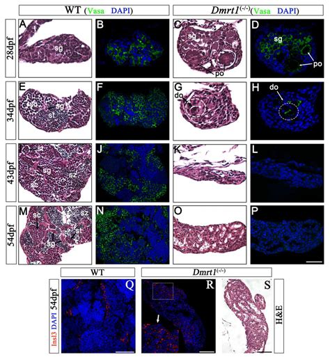 Dmrt1 Is Required For Male Germ Cell Development And Testicular Lobule