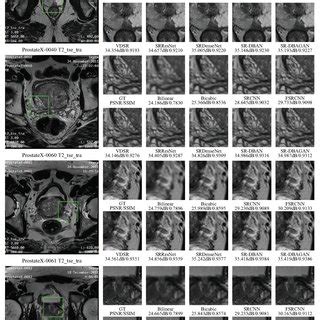 Comparison Of Qualitative Results Of Each Super Resolution Algorithm