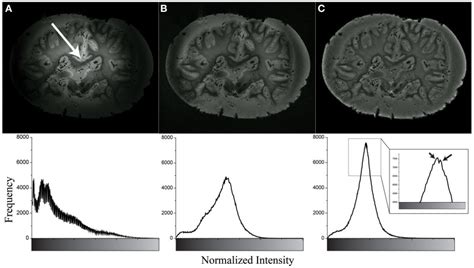 Example Of Inhomogeneity Correction Of Original Image A Using N4 Bias Download Scientific
