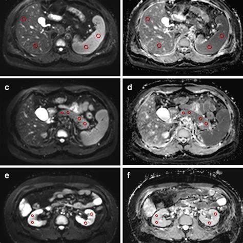 Axial Single Shot Echo Planar Simultaneous Multislice Accelerated Download Scientific Diagram
