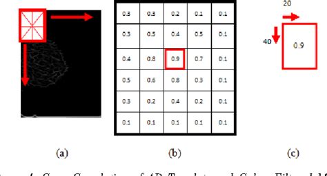 Figure 1 From Automated Detection Of Architectural Distortions In Mammograms Using Template