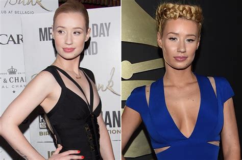 Iggy Azalea ‘i Got Bigger Boobs Page Six