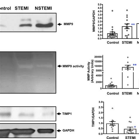 Plasma Biomarker Evaluation In Stemi And Nstemi Blood Was Taken From