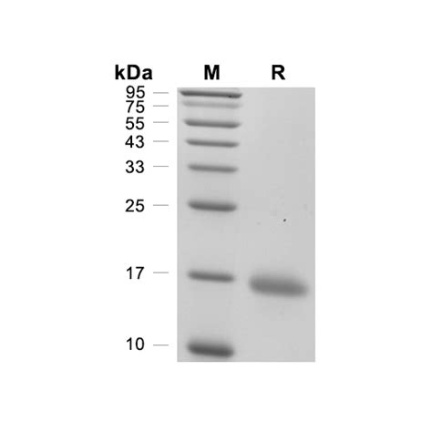 Gm Csf Protein Human His Medchemexpress