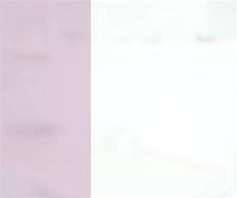 Kevin Lucas On Linkedin Amradmedical Bennet Innovet Americomp Xray Radiology Dr Doctor…