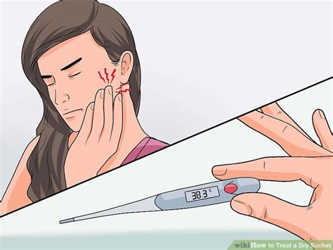 How To Treat A Dry Socket Steps With Pictures WikiHow