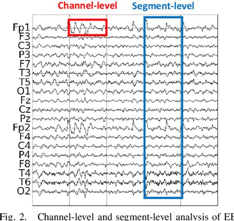 Transformer Convolutional Neural Networks For Automated Artifact