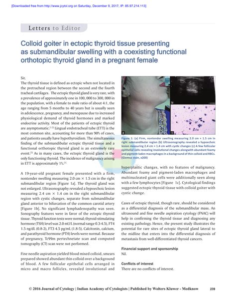 Pdf Colloid Goiter In Ectopic Thyroid Tissue Presenting As Submandibular Swelling With A
