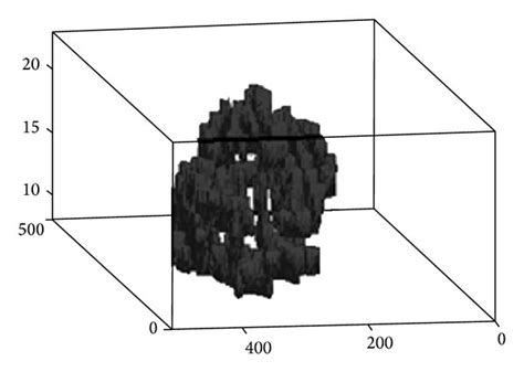 Example Of Phenotype Segmentation A Raw Image Of Flair Sequence B