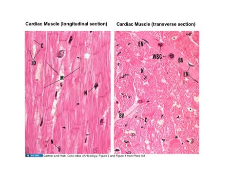 Cardiac Muscle Histology Cross Section