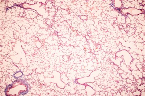 광학 현미경으로 본 인간의 폐 병리학 폐는 인간의 호흡기 기관입니다 코르티기관에 대한 스톡 사진 및 기타 이미지 코르티기관