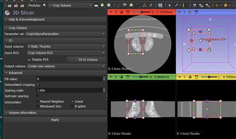 How To Call Createnewroi And Cropvolume In Python Script Support 3d Slicer Community