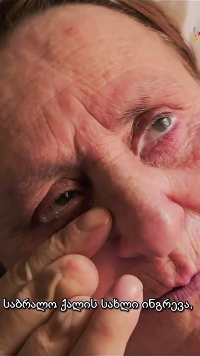 🆘🙏💔უსინათლო ბებია მისი მძიმედ დაავადებული შვილი და შვილიშვილი განწირულნი არიან მტანჯველი Youtube