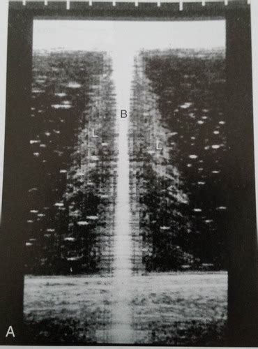 Propagation Of Ultrasound Through Tissues Part 2 Flashcards Quizlet