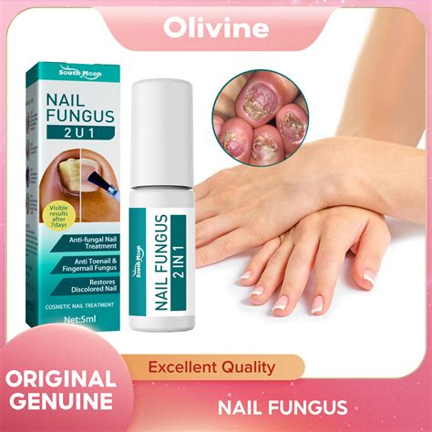 South Moon Nail Repair Liquid Effective Treatment Onychomycosis