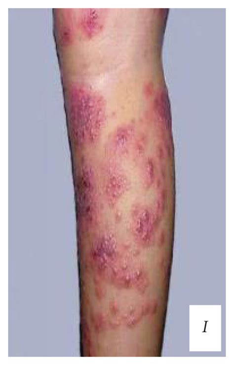 Image Of The Transformation Of Euclidean Distance A Filtering Image