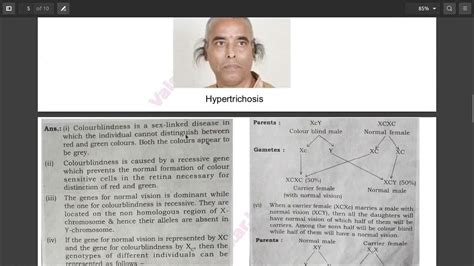 Sex Linked Inheritance Sex Determination Std Xii Biology Lesson 3 Youtube