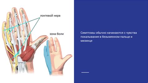 Синдром канала Гийона Статьи