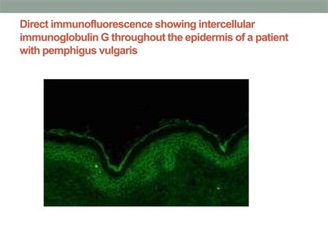 Bullous Skin Disordersppt Skin And Dermatology Diseases And Conditions