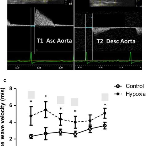 Evolution Of Aortic Pulse Wave Velocity In Prenatal Hypoxia Versus