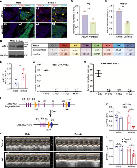 Cardiac Proteomics Reveals Sex Chromosome Dependent Differences Between