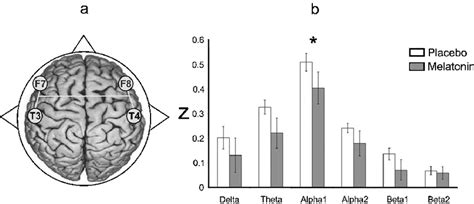 A Representative Diagram Of The EEG Derivations In Which Significant Download Scientific