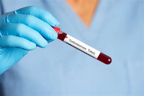How To Test Testosterone Levels Test Results Explained