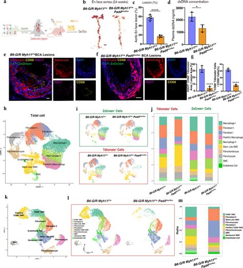 Et Inhibition Reduced The Cd68⁺ Vsmcs And Scrna Seq Identified Multiple Download Scientific