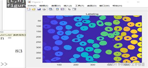 Matlab 练习：细胞计数（imfillandopenanderosion的综合应用）matlab细胞计数 Csdn博客