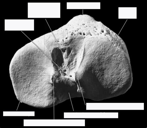 Tibia Right Proximal Diagram Quizlet Tibia Right Proximal Diagram Quizlet