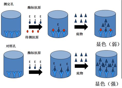 四张图轻松了解elise的四种类型 搜狐大视野 搜狐新闻