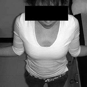 PDF The Instability Severity Index Score A Simple Pre Operative Score To Select Patients For