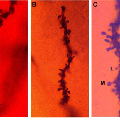 The Extent And Distribution Of Neuronal Dendritic Branching In The Download Scientific Diagram