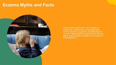 Eczema Myths And Facts Ppt Slides Acp Ppt Powerpoint
