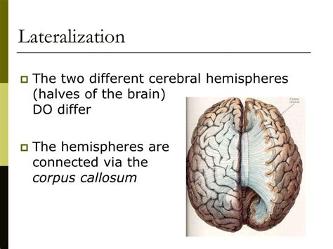 Ppt Hemispheric Specialization I Powerpoint Presentation Free Download Id5488457