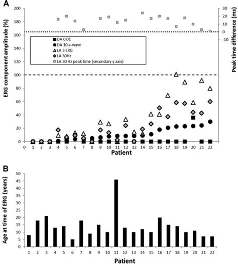 Rp2 Associated X Linked Retinopathy Ophthalmology