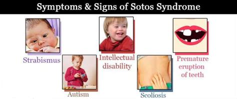 These Are The Symptoms And Signs Of Sotos Syndrome Medizzy