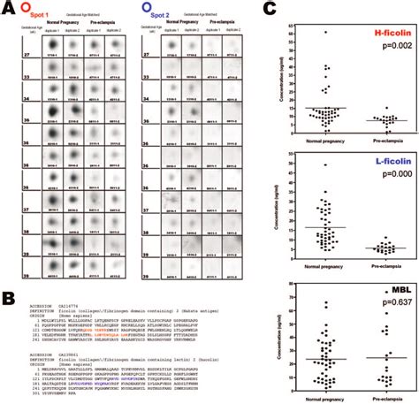 Comparative Proteomic Analysis In Preeclampsia Download Scientific Diagram