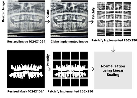 Figure From Semantic Segmentation On Panoramic Dental X Ray Images Using U Net Architectures