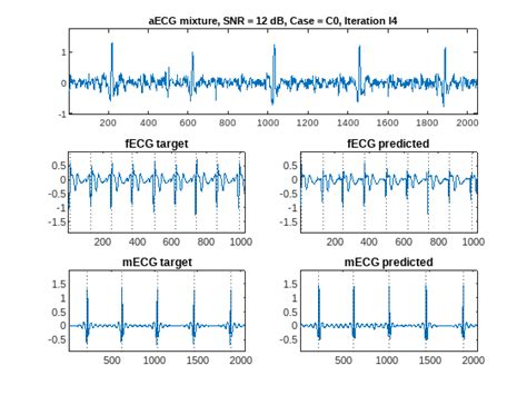 Signal Source Separation Using W Net Architecture MATLAB Simulink