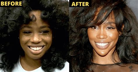 Unmasking Szas Transformation A Deep Dive Into Her Pre Surgery Appearance