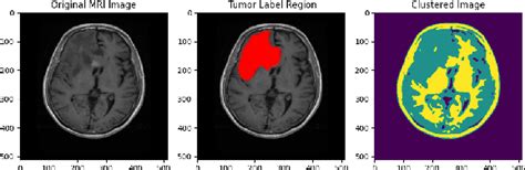 Integrating Preprocessing Methods And Convolutional Neural Networks For