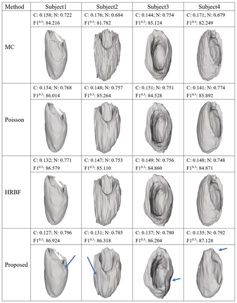 Examples Of 3d Left Myocardium Reconstruction Results On Four Different Download Scientific
