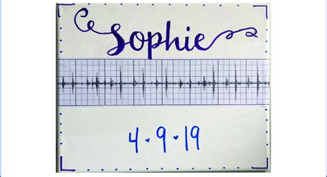 Sample Artwork Surrounding Sample Cardiac Phonocardiogram Download