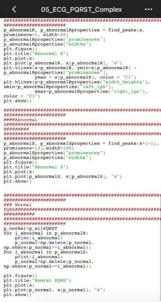 Solved Examine The Entire Ecg Signal With Stft Prepare The