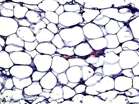 A Adipose Tissue Hematoxylin Eosin He Staining ×200 B Download Scientific Diagram