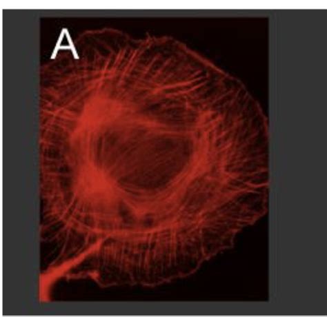 Module The Cytoskeleton Flashcards Quizlet
