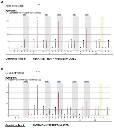 Cancers Special Issue Sex Differences In Cancer